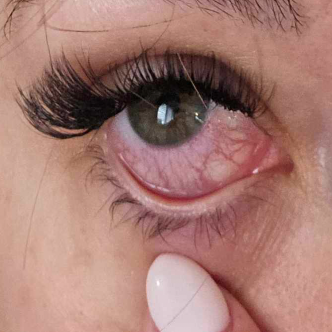 LASH EXTENSIONS AND CHEMICAL PINK EYE – Elusive Beauty